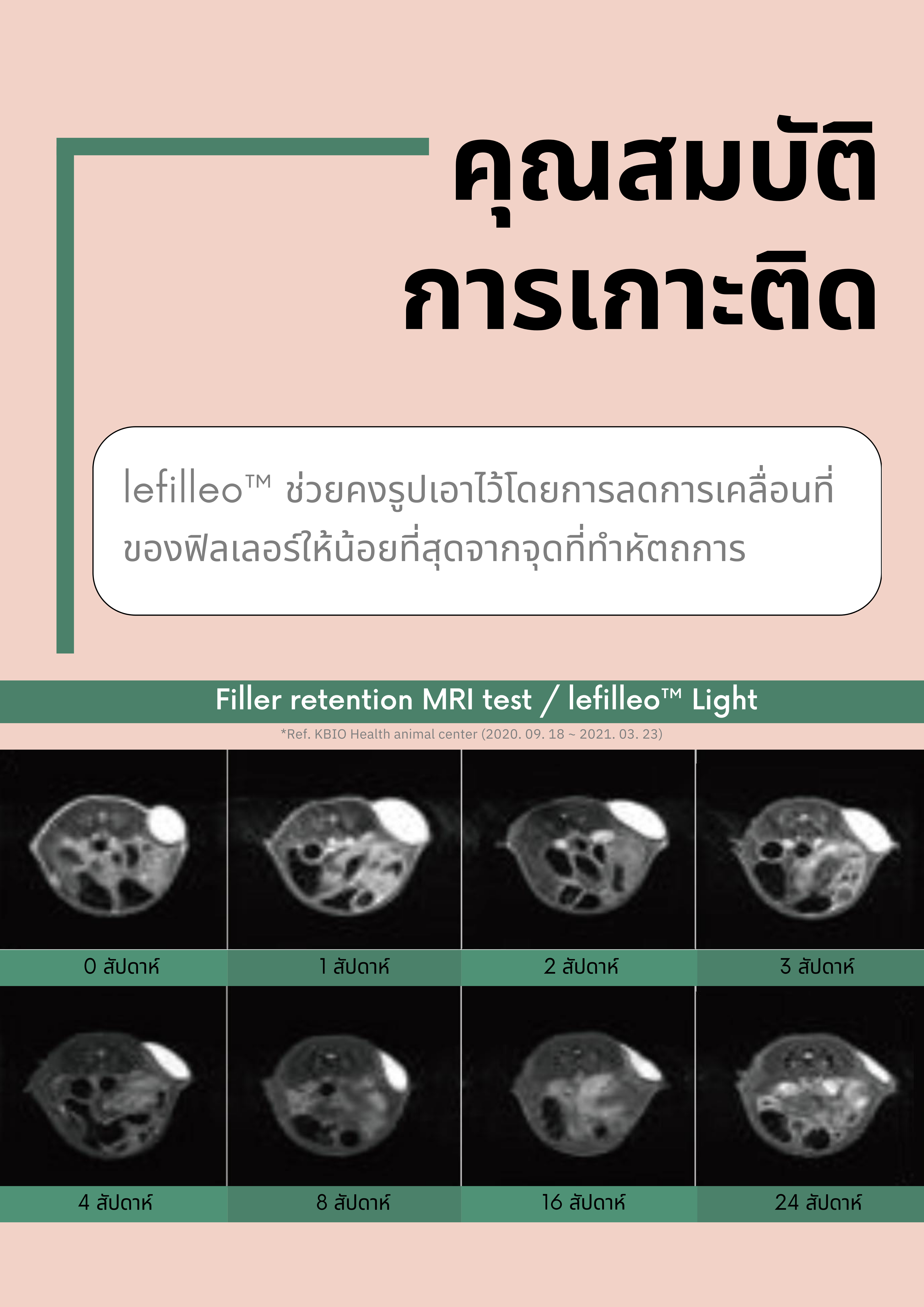 HA Filler – Sharing Global
